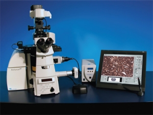 Laser Capture Microdissection